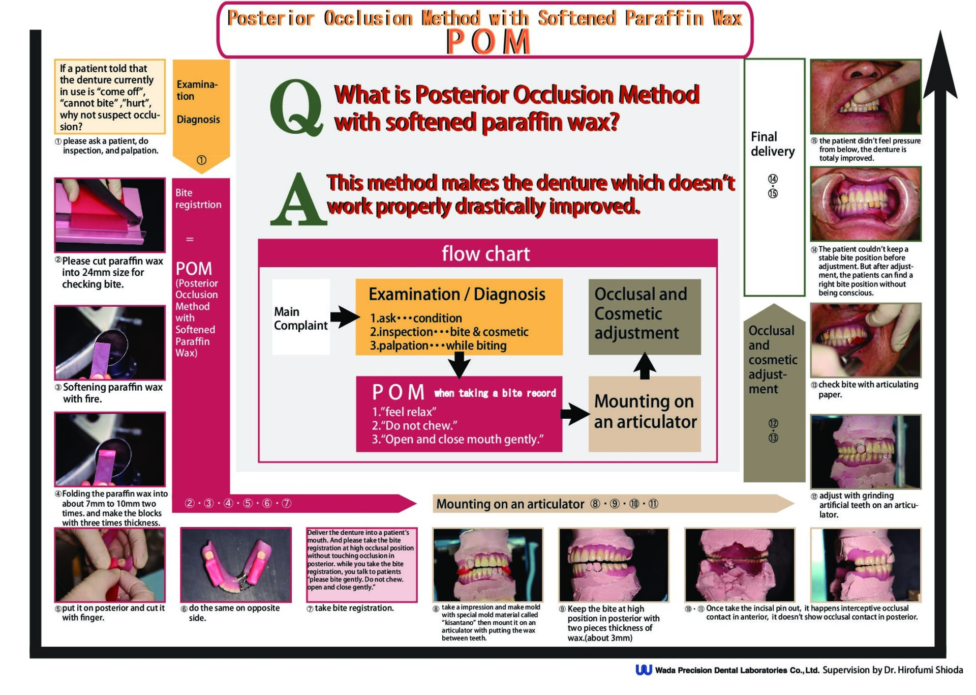 Technique – Wada Precision Dental Laboratories U.S.A.